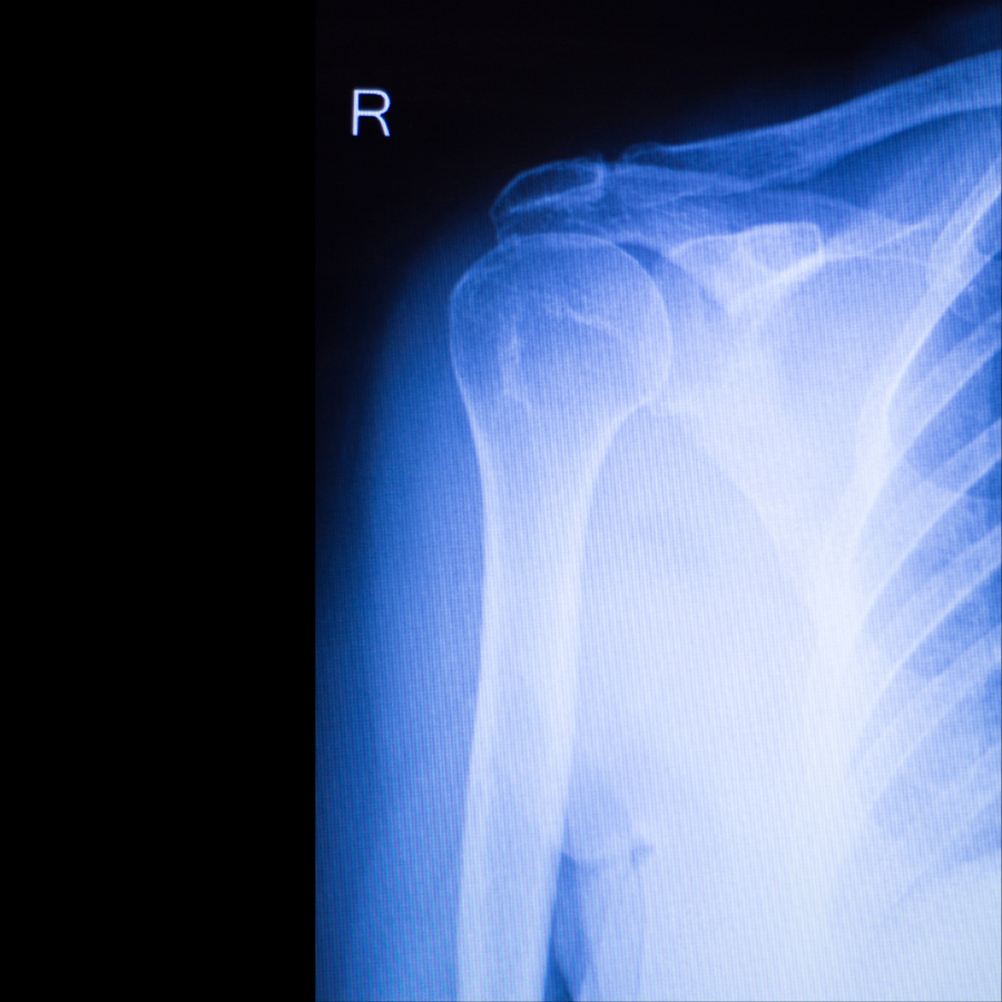 Common Orthopedic Conditions – corfumedica